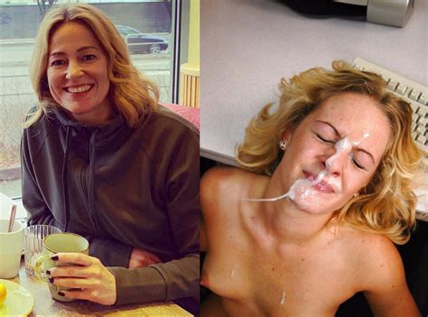 Before After Facials F1 9 Porn Pic Eporner