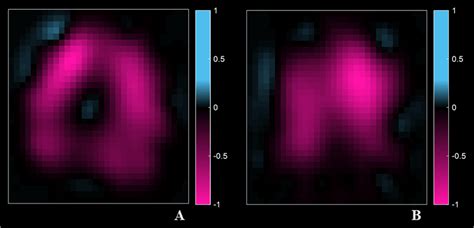 Example Of Eit Images During Forced Expiration Maneuver ∆fev1eit In Download Scientific