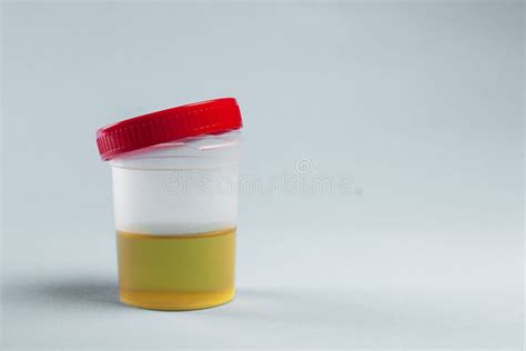 Jar With Urine Tests In Yellow On White Background With An Open Lid In