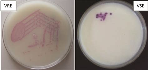 Hicrome Vre Showing Vre Positive Control And Negative Isolate