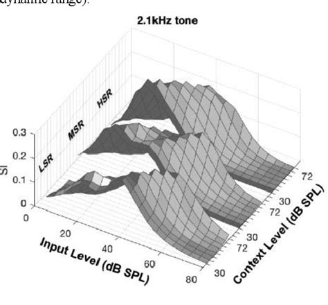 Figure 1 From Differential Diagnosis Of Auditory Nerve Damage Through