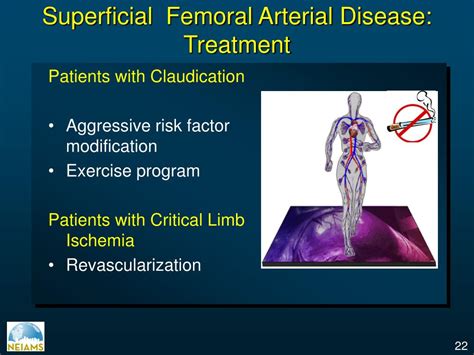 Ppt Superficial Femoral Artery Disease Simulation Training