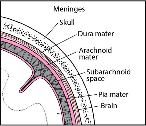 Jipu La Epidural Intracranial Na Subdural Empyema Jipu La Epidural