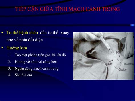 PPT ĐƯỜNG TRUYỀN TĨNH MẠCH TRUNG TÂM PowerPoint Presentation ID 490865