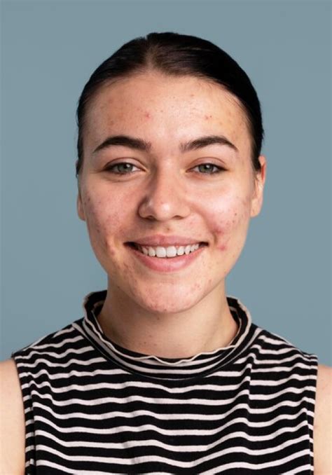 Pigmented Skin Haven Cosmetic