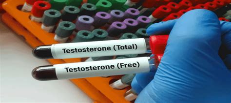 Testosterone Test Testosterone Levels Procedure And Result Healthcareontime