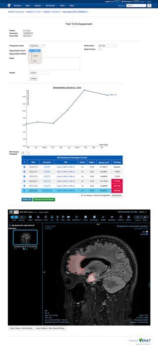 Ucsf Center For Intelligent Imaging On Linkedin Implementation And Prospective Real Time