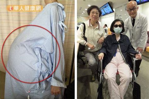 罕見！卵巢腫瘤重30公斤如10胞胎 華人健康網 專業即時優質的健康新聞及資訊分享平台業即時優質的健康新聞及資訊分享平台