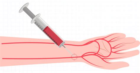 Arterial Blood