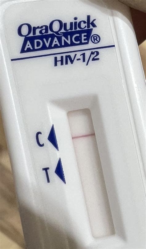 Std Or Yeast Infection R Std