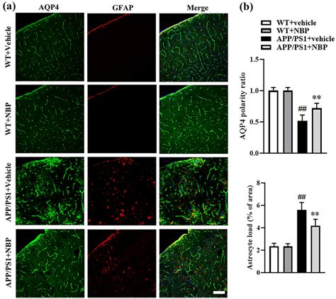 A Increased Expression Of Gfap And Aqp4 In The Cortical Cortex Of