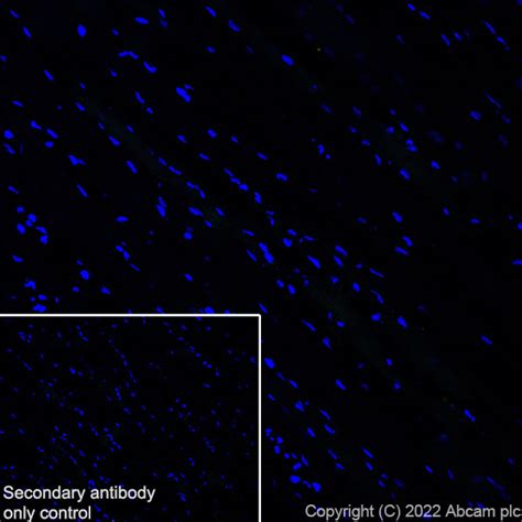 Recombinant Anti Nptxr Antibody [epr25684 3] Bsa And Azide Free