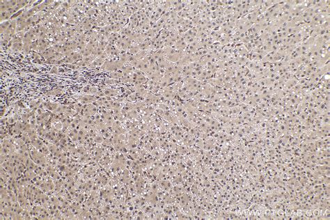IHCeasy SMAD2 Ready To Use IHC Kit KHC0126 Proteintech 武汉三鹰生物技术有限公司