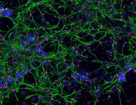 Research — Chetty Lab