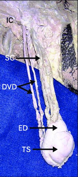 Spermatic Cord Contents