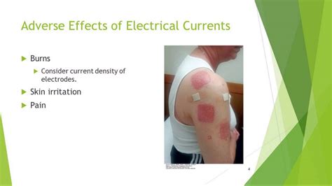 Chapter 11 Lecture Part 3 Contraindication And Precautions And Devices Youtube