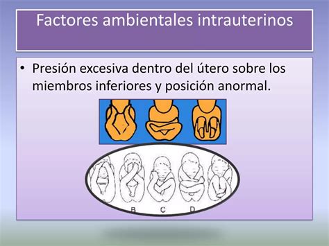 Displasia Del Desarrollo De Las Caderas PPT
