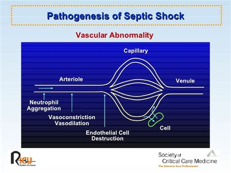 Sepsis To Septic Shock