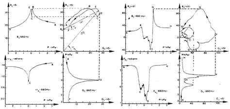 Tympanometry