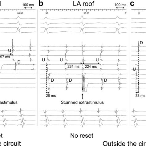 The Relationship Between The Tad Tau And Ppi Tcl Ppi Post Pacing Download Scientific Diagram