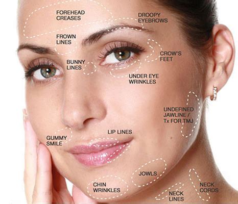 Facial Esthetics Back Basics Dentistry Clarksville Tn
