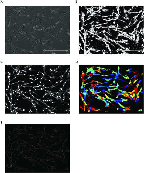 processing stages of the morphology quantification pipeline using