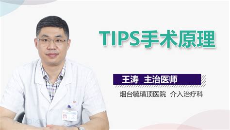 Tips