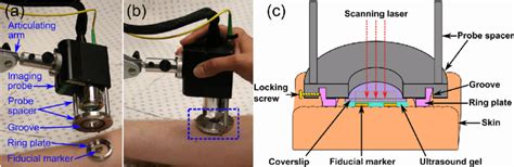 PS OCT Imaging Interface For Coupling The Imaging Probe And The Skin Download Scientific