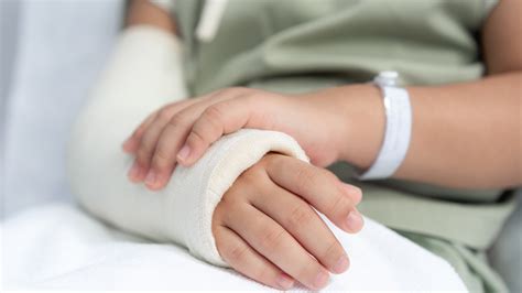 Whats The Difference Between A Fracture And A Broken Bone — Dr Nick