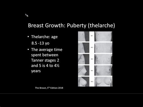 Endocrinology Diabetes And Bone Disease Icahn School Of Medicine