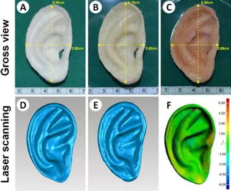 中国科学家用软骨细胞和3d打印技术为小耳症儿童培育新耳朵 3d科学谷