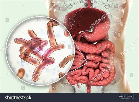 Vibrio Cholerae Bacteria Small Intestine 3d 库存插图 1204499152 Shutterstock
