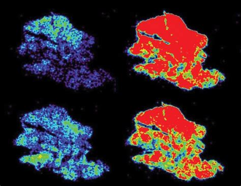 mass spectrometry of tissues for biomarker discovery bcm