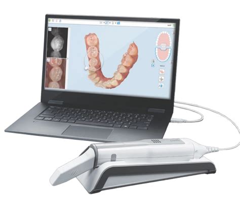 Revolutionize Your Practice With A Free Itero™ Ios Digital Scanner