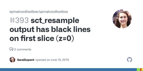 sct resample output has black lines on first slice z 0 · issue 393
