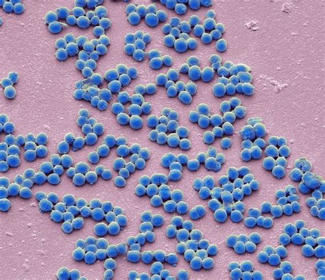 Group A Streptococcus Bacteria Sem Stock Image C0573770 Science