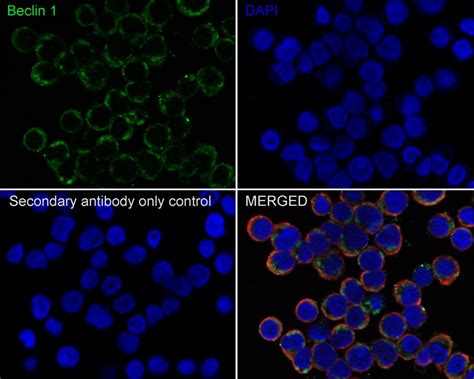 Beclin Recombinant Rabbit Monoclonal Antibody JE HA HUABIO