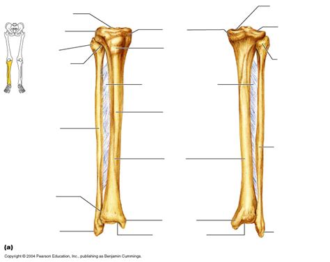 Anterior Crest Of Tibia Tibial Crest Avulsion