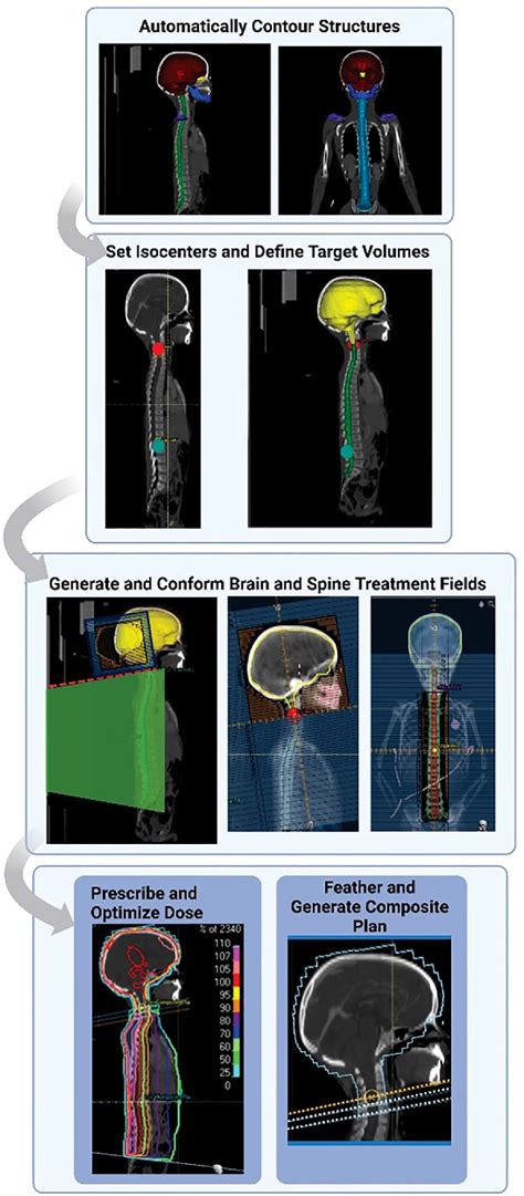 Figure 1 From Validation Of An Automated Contouring And Treatment
