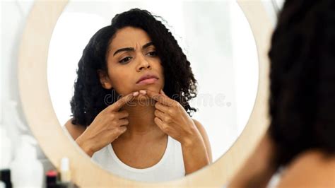 Problem Skin Concept African American Girl Looking In Mirror And