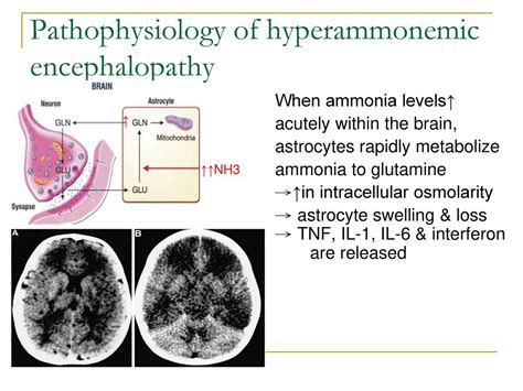 Ccm Presentation The Forgotten Area In Icu ………… Fertility Ppt Video Online Download