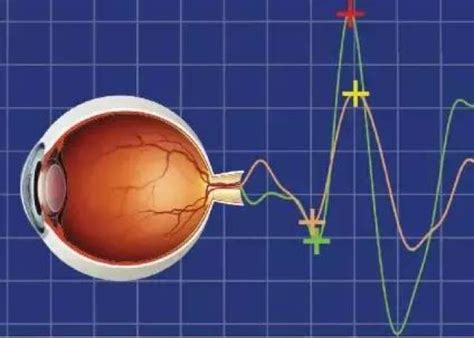 视网膜电图眼电图视网膜图片大山谷图库