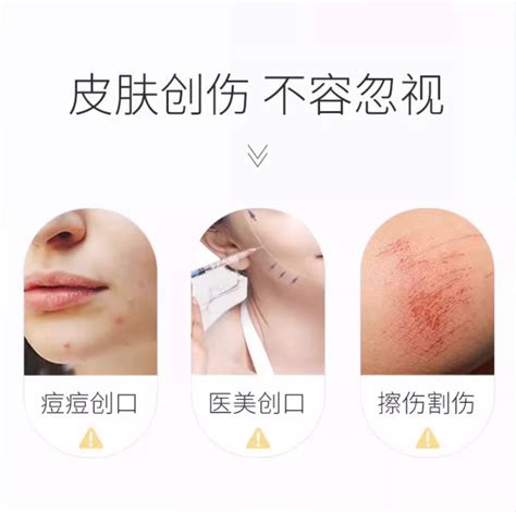 敷尔佳医用重组iii型人源化胶原蛋白贴 Voolga Official Store