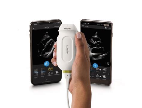 Philips Lumify Handheld S4 1 Phased Array Ultrasound Lumify Store