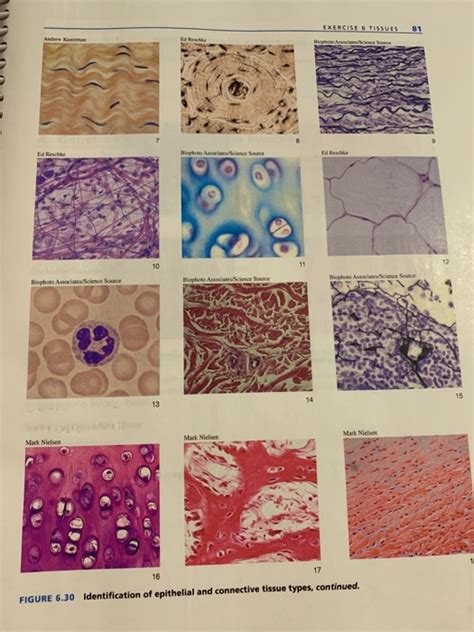 Solved 80 Exercise And Tissues E Epithelial And Connective