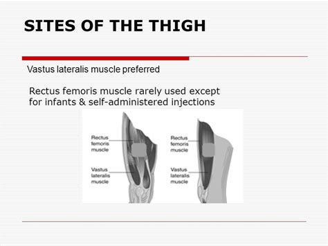 Vastus Lateralis Muscle Injection Site