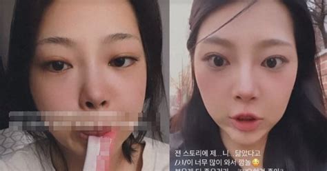 10기 옥순 팅팅 부으니 제니 닮은꼴 “엄마한테 말했더니 남자셋 여자셋”