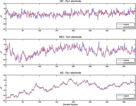 Original And Reconstructed Eeg Recordings For Three Groups Healthy Download Scientific Diagram