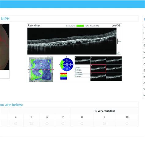 Question Illustrating The Central Retina With The Corresponding Optical Download Scientific