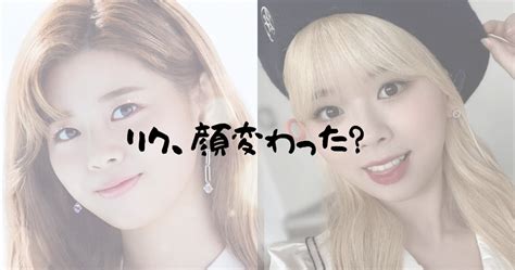 NiziUリクは整形で二重鼻口が変わった画像比較で調査 Coco NAVI ココナビ